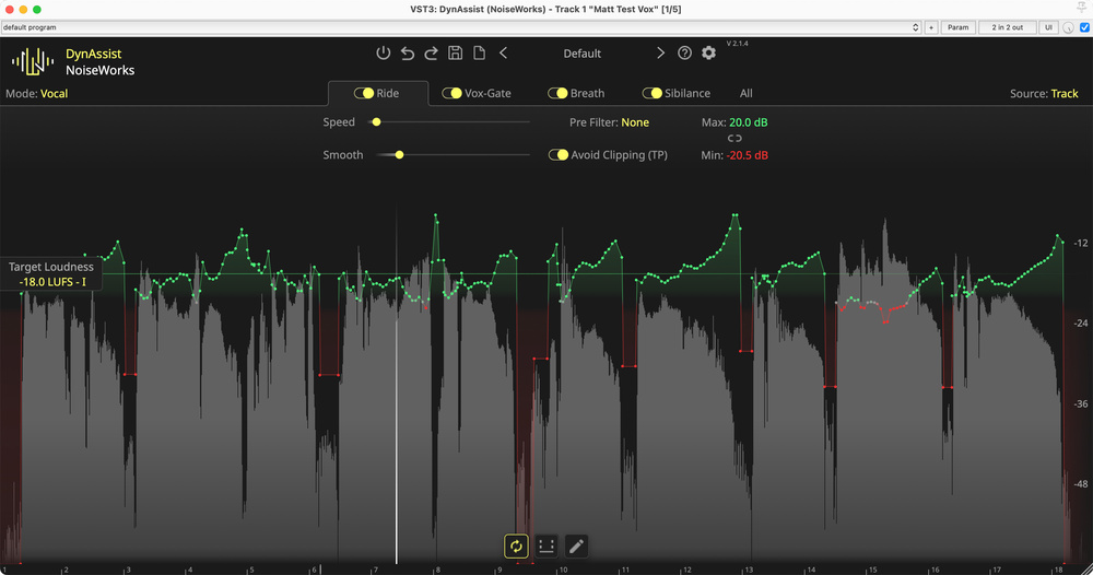 NoiseWorks Audio DynAssist